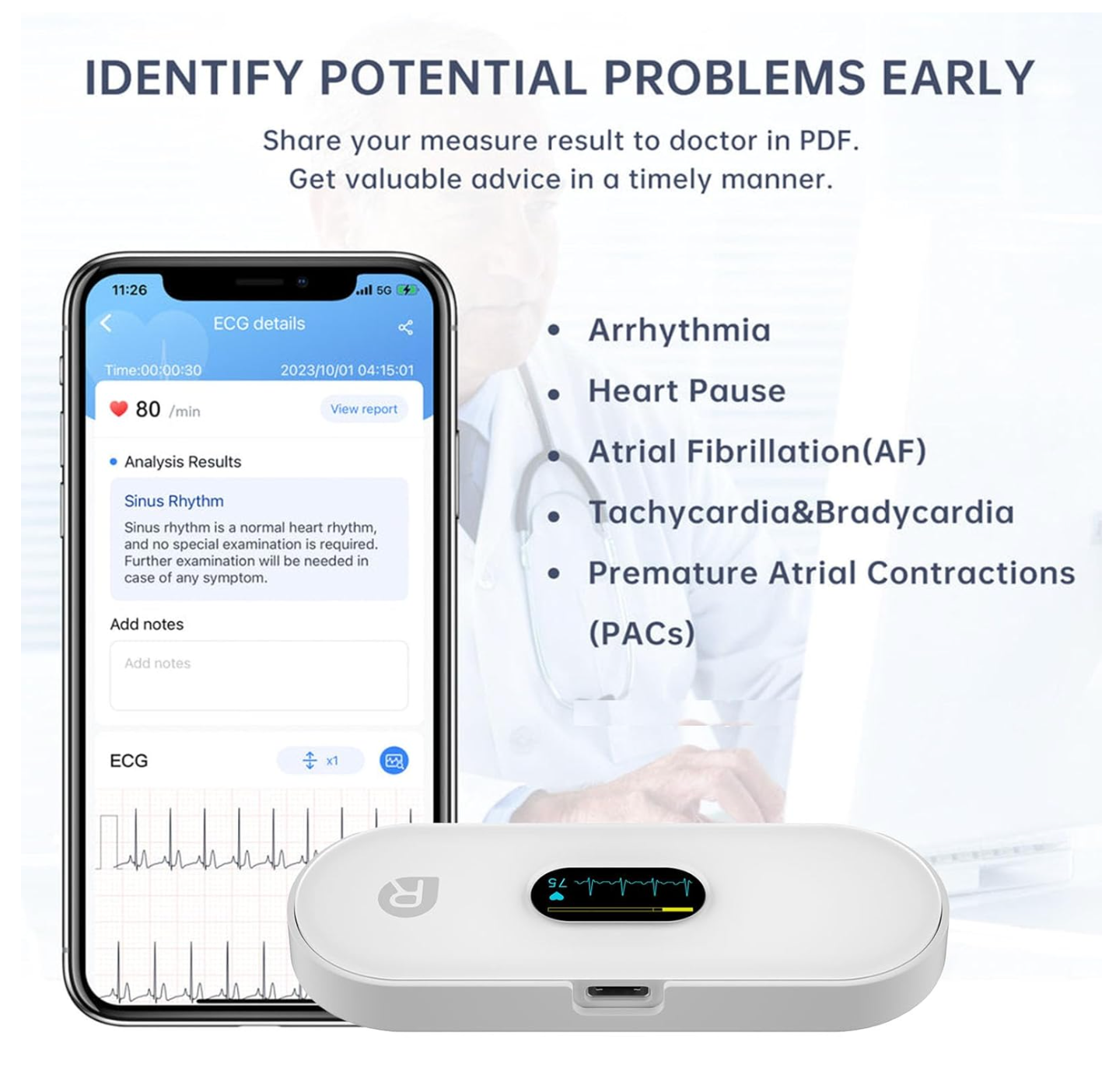 CheckMe Monitor ECG Portátil Bluetooth con Pantalla OLED y App para iO ...